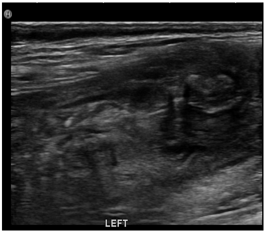 description of image here